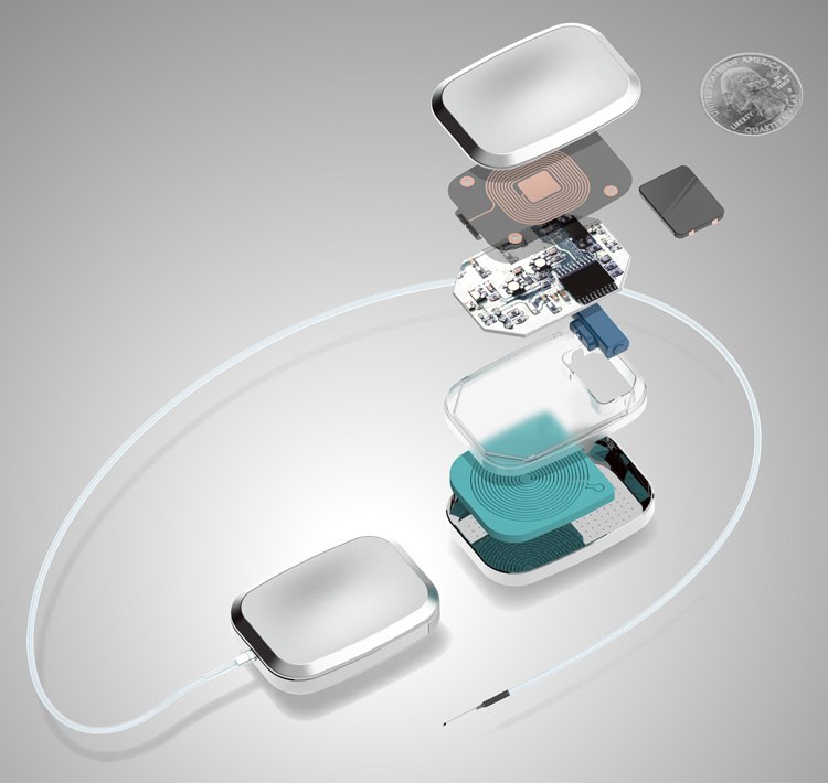Miniature active implantable medical devices for drug delivery ...